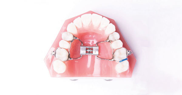 Hyrax (spin) beugel | Ortho Uithoorn